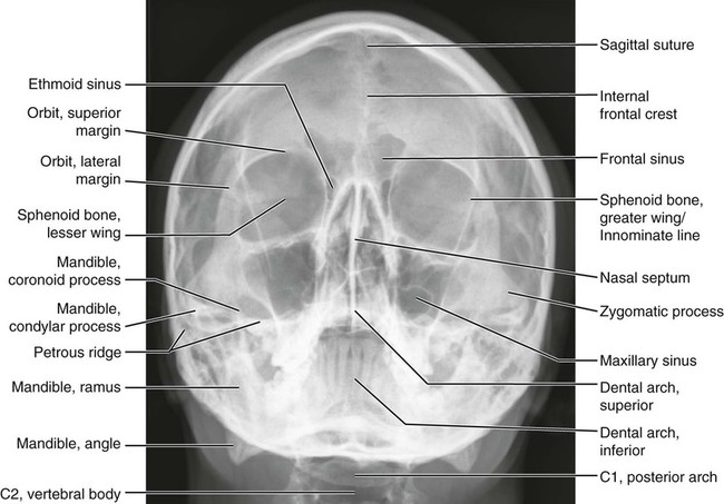 小朋友能照X光嗎？ - n0160508的創作 - 巴哈姆特